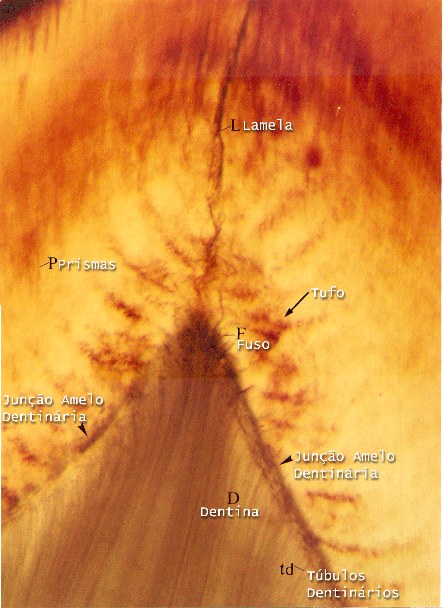 Junção amelo-dentinária sob luz transmitida — UNIVERSIDADE FEDERAL DA ...